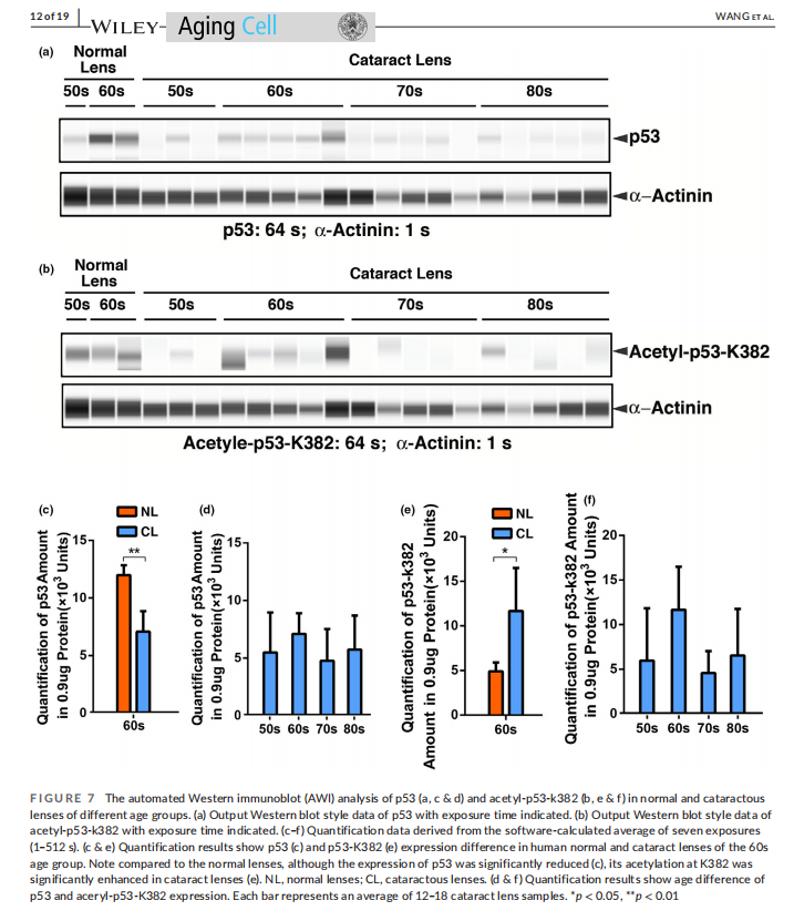 中山大学中山眼科中心仪器共享平台|支撑成果